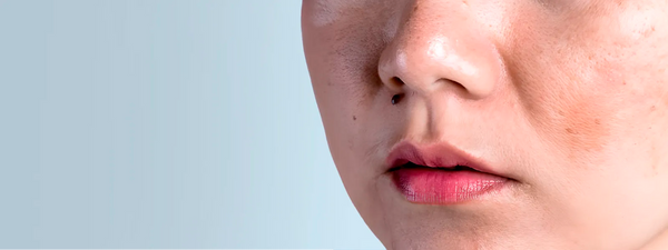 Skin Oxidation: What You Need To Know - RecoverX Skincare