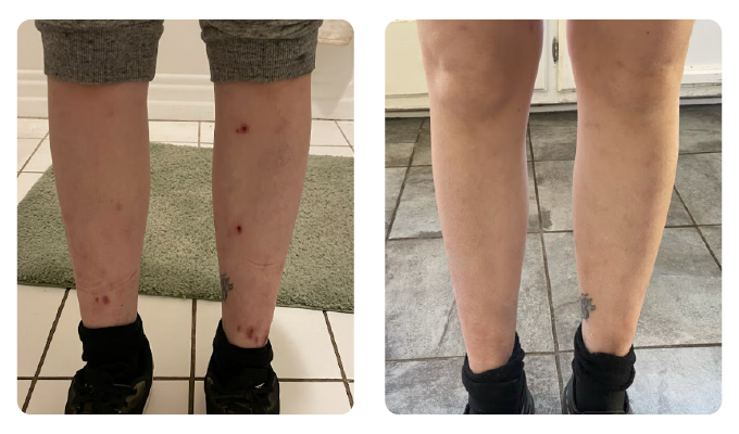 RecoverX Before and Afters - RecoverX Skincare