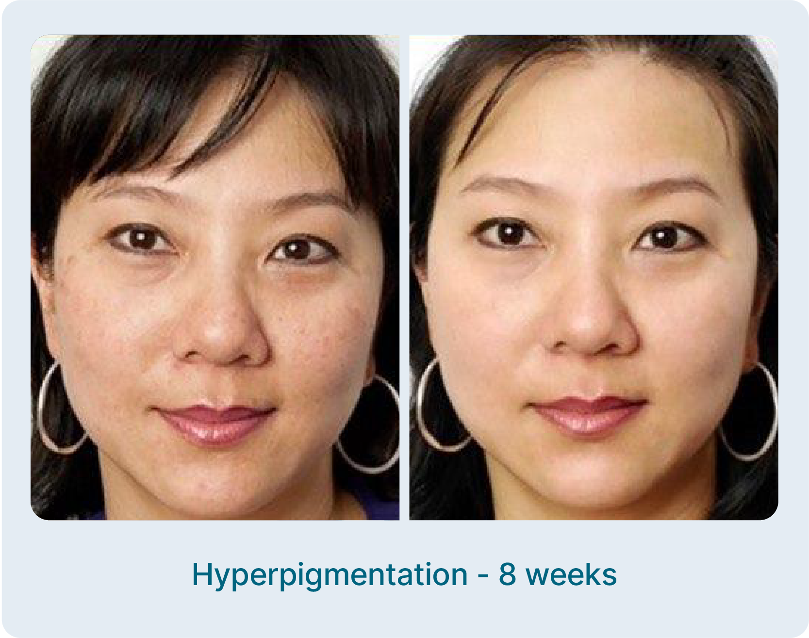 RecoverX Before and Afters - RecoverX Skincare