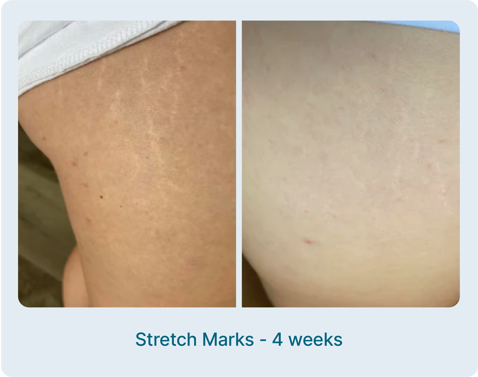 Before & After - RecoverX Skincare