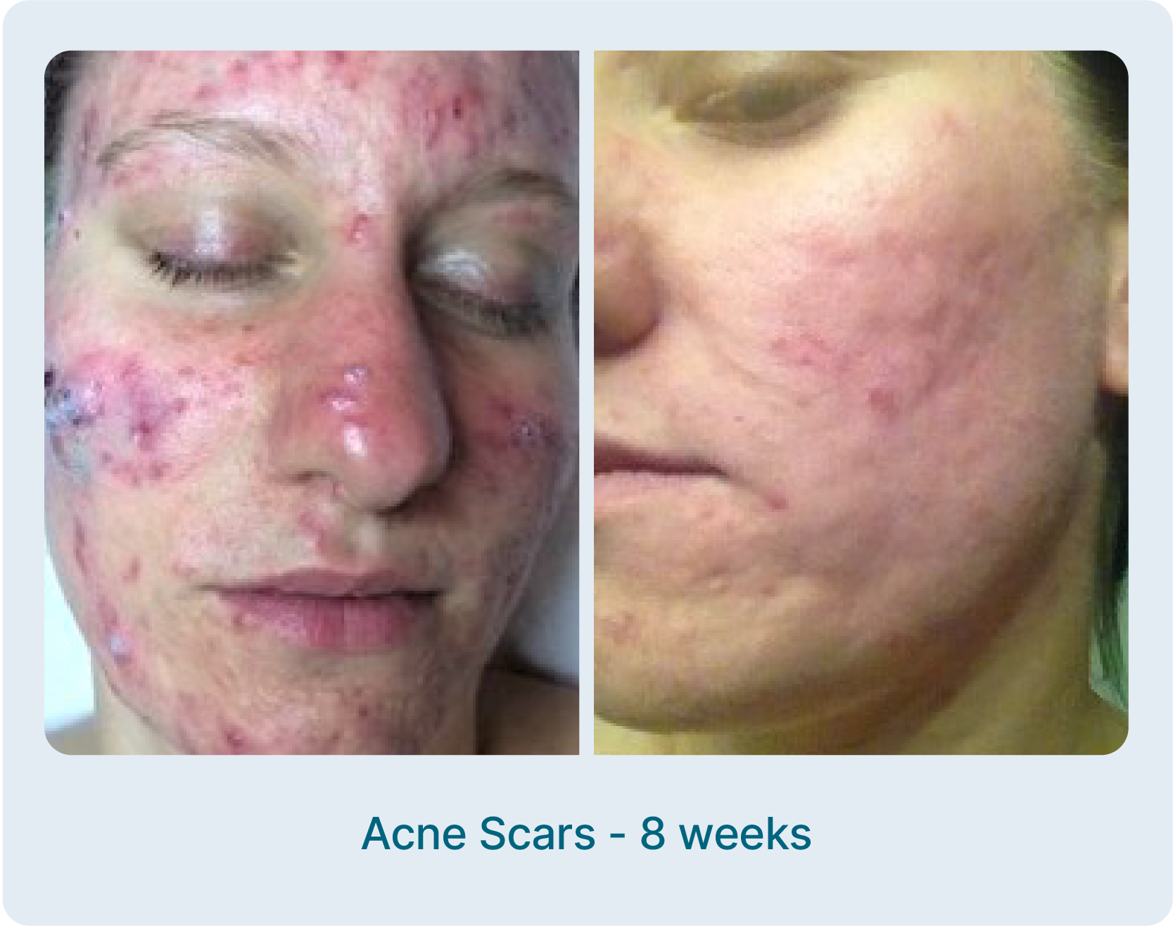 RecoverX Before and Afters - RecoverX Skincare