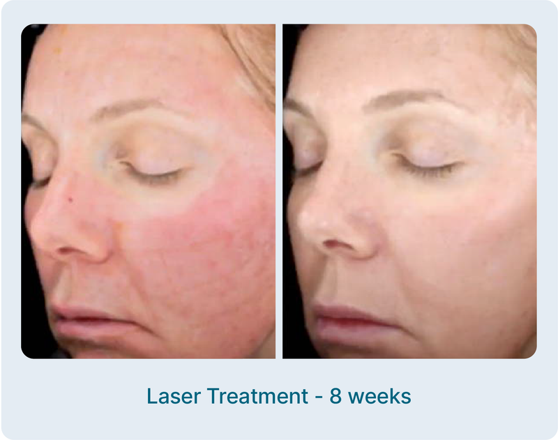 RecoverX Before and Afters - RecoverX Skincare