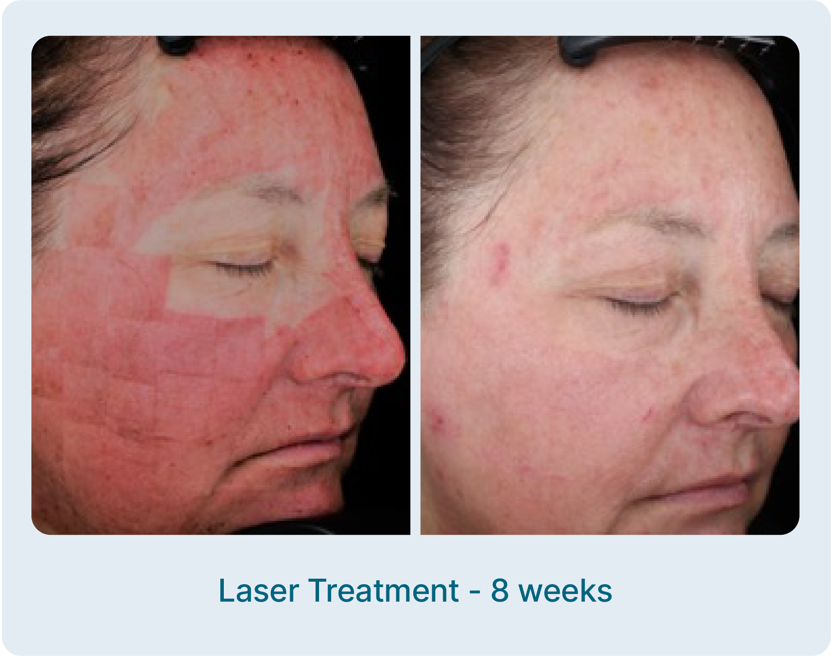 RecoverX Before and Afters - RecoverX Skincare