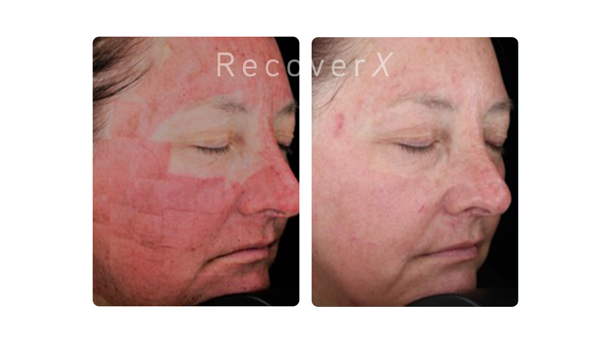 Consumer Studies - RecoverX Skincare